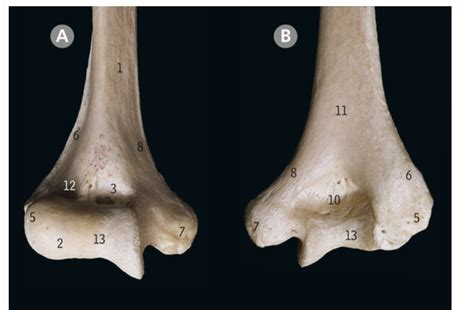 Right Distal Humerus Diagram Quizlet