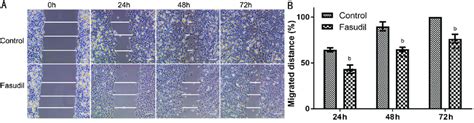 Inhibition Of Sra0104 Cell Migration Is Shown Monolayer Wound Assay