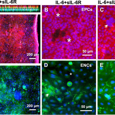 Effects Of Treatments With Il 6 Sil 6r 500 Ngml Vs Download