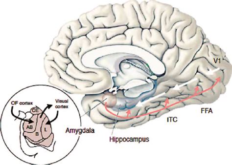 Fusiform Gyrus Prosopagnosia