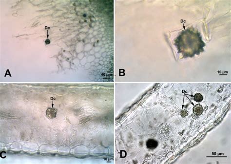 Calcium Oxalate Crystals In Plants