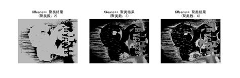 【基于kmeans、kmeans 和二分k均值算法的图像分割】数据挖掘实验三 csdn博客