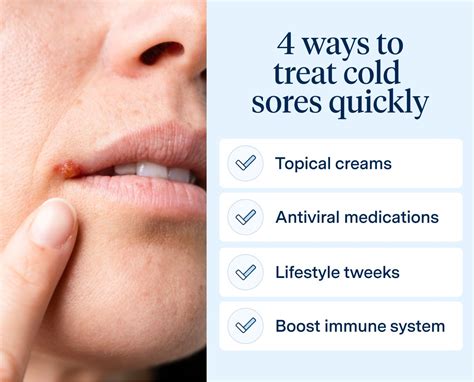 How To Rid Of A Cold Sore Quickly Treatment Options Aspen Dental