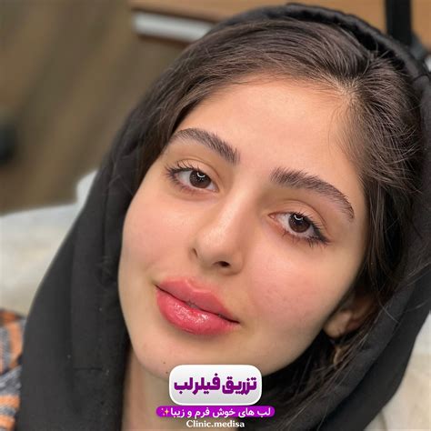 ‎کلینیک زیبایی و لیزر مدیسا كندلا سنتر ياسوج ‎ Clinicmedisa • Instagram Photos And Videos