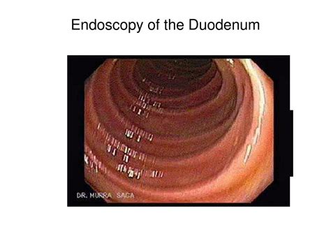 Ppt Gastrointestinal Motility Powerpoint Presentation Free Download