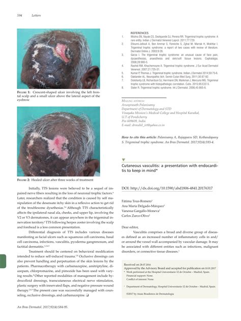 Pdf Cutaneous Vasculitis A Presentation With Endocarditis To Keep In