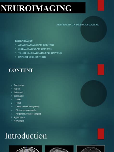 Neuroimaging Download Free Pdf Neuroimaging Medical Imaging