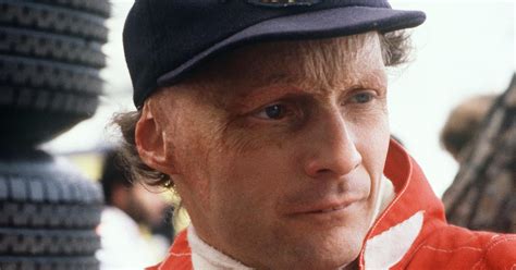 Niki Lauda Before And After
