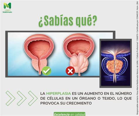 Laboratorio ¿sabías Qué La Hiperplasia Es Un Aumento En El Número De