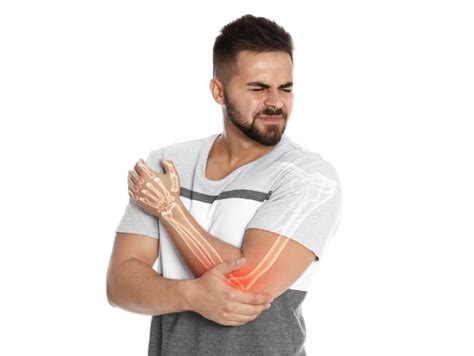 O Que é Osteoartrose De Cotovelo — Portal Da Ortopedia