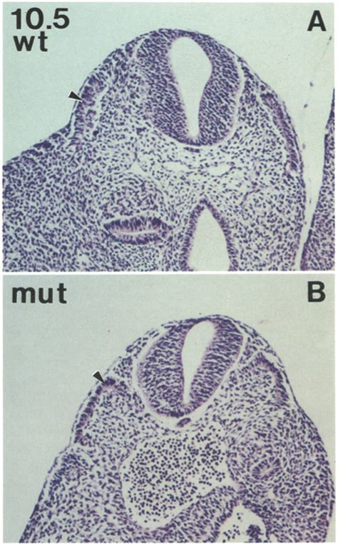 Somite And Early Muscle Development In Myogeninmutant Embryos The