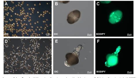 Pine Pollen Microscope