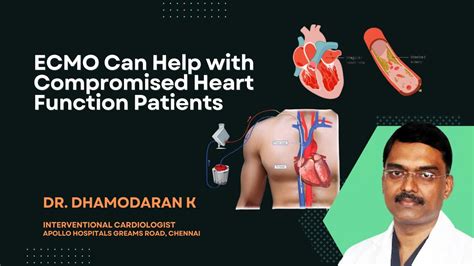 Ecmo Can Help With Compromised Heart Function Patients Dr Dhamodaran