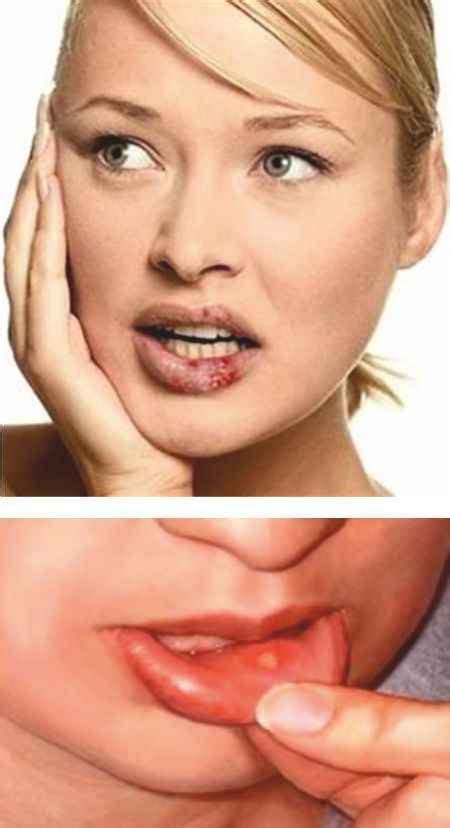 Aft Neden Olur Bolu Gündem