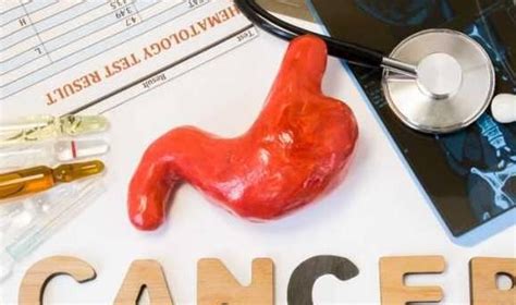 胃癌晚期还能活多久？ 知乎