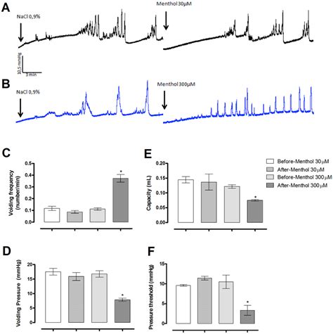 In Vivo Bladder Function Assessed By Cystometry During Instillation Of
