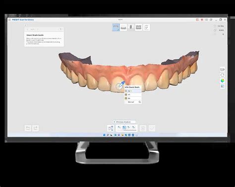 Medit Scan For Clinics Medit Intraoral Scanner And Dental Software