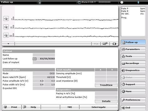 Perioperative Interrogation Of Biotronik Cardiovascular Implantable