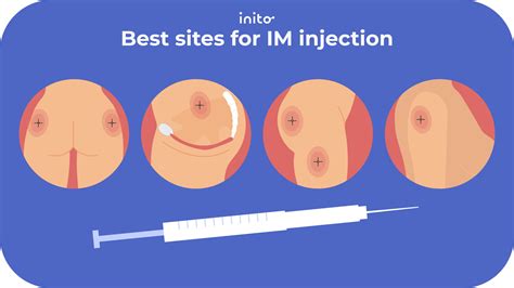 Six Common Hcg Trigger Shot Mistakes To Avoid Inito