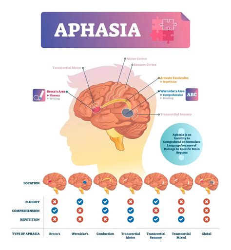 6 Types Of Speech Impediments Speech Blubs Guide