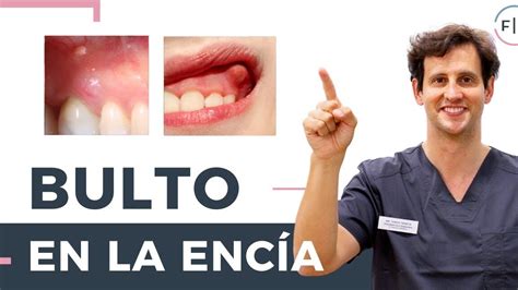 Agujero En La Encía Detrás De La última Muela Causas Y Soluciones