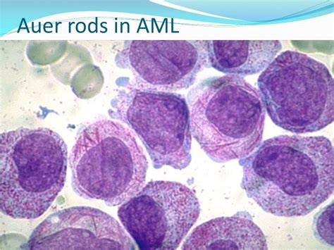 Ppt Hematopathology Powerpoint Presentation Free Download Id