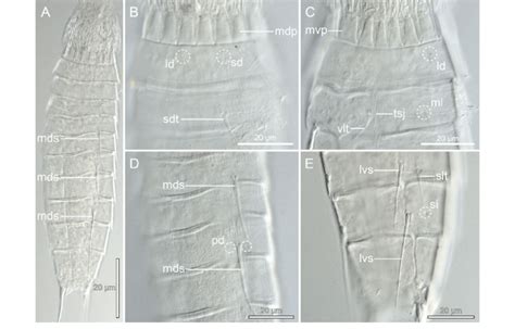 Light Micrographs Showing Details Of Neck And Trunk Morphology In