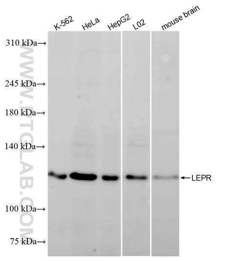 Lepr Antibody 84464 4 Rr Proteintech 武汉三鹰生物技术有限公司