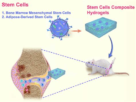Schematic Diagram Of The Synthesis Of Stem Cell Composite Hydrogels And