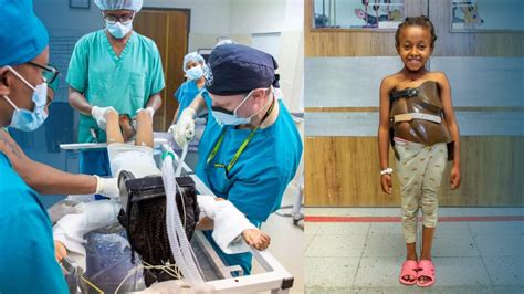 Betselots Story Her Deformity Does Not Define Her Identity Tim