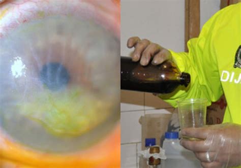 “yo De Ti Me Tiraba De Un Quinto Piso” Le Dijo Una Enfermera A Un Paciente Que Perdió La Visión