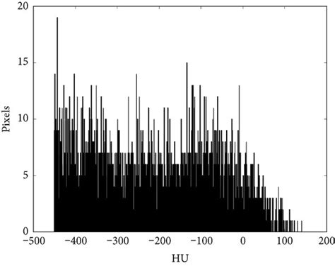 Histogram Of A Malignant Nodule With A Leptokurtic Ie Resembling A