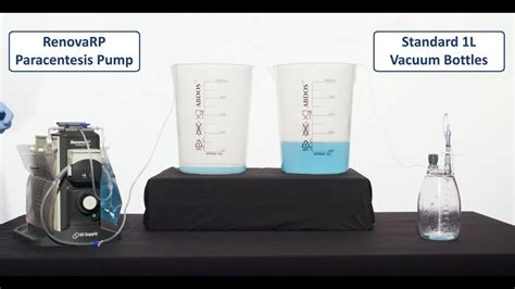Renovarp® Paracentesis Pump Vs Vacuum Bottles Youtube