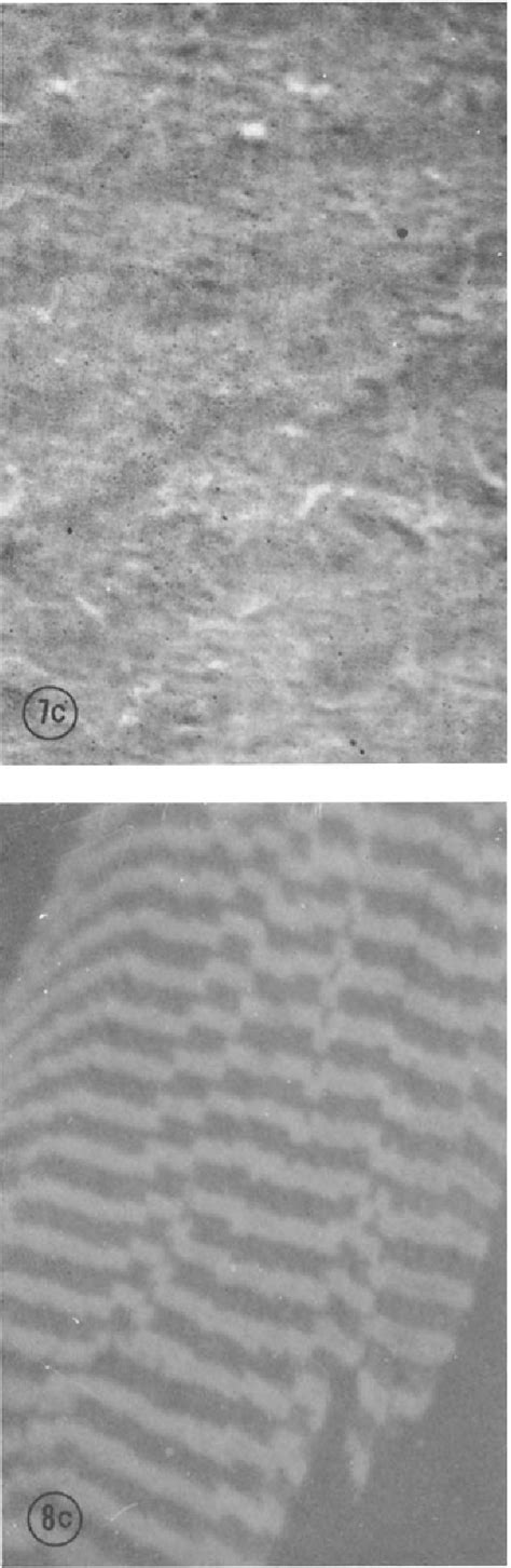 Figure 85 From The Use Of Specific Antibody In Electron Microscopy