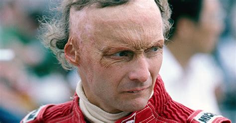 Niki Lauda El Piloto De Fórmula 1 Que Salió Vivo De Las Llamas De Nurburgring Se Dedicó A Las