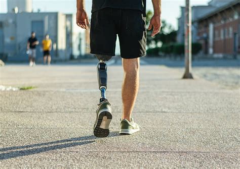 Amputee Rehabilitation Toronto Balance Physiotherapy