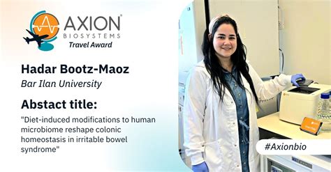 David Ferrick On Linkedin Ei9ituvm