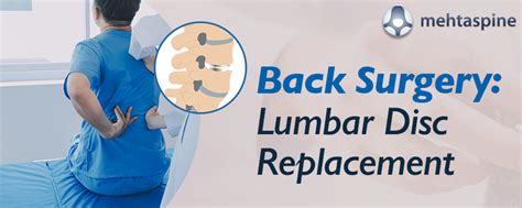 Back Surgery Lumbar Disc Replacement