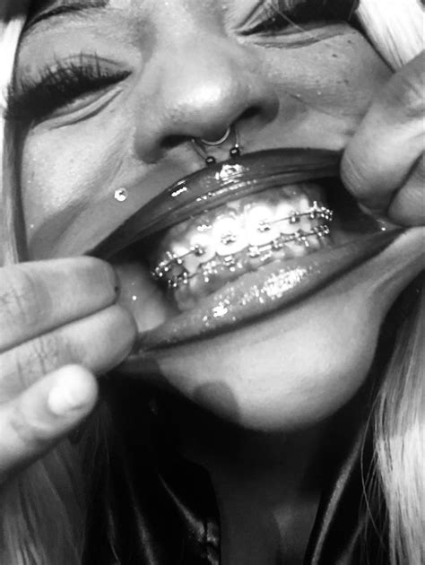 Pin By Donna Jean On 2025 Vision Board Teeth Aesthetic Silver Braces Brace Face