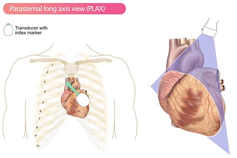 Standard Transthoracic Echocardiogram Complete Imaging Protocol Cardiovascular Education