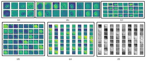 Gastrointestinal Tract Polyp Anomaly Segmentation On Colonoscopy Images