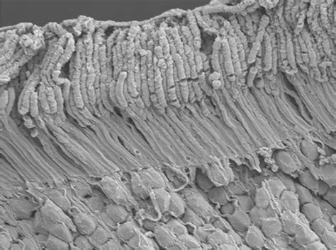 Scanning Electron Microscope Sem Of The Outer Portion Of A Mouse