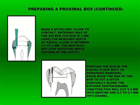 Class Ii Amalgam Preparation Ppt