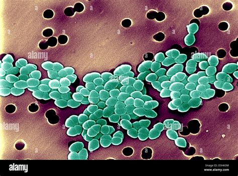 Vancomycin Resistente Enterokokken Fotos Und Bildmaterial In Hoher