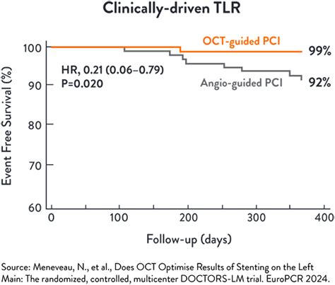 Oct Vs Angiography Abbott