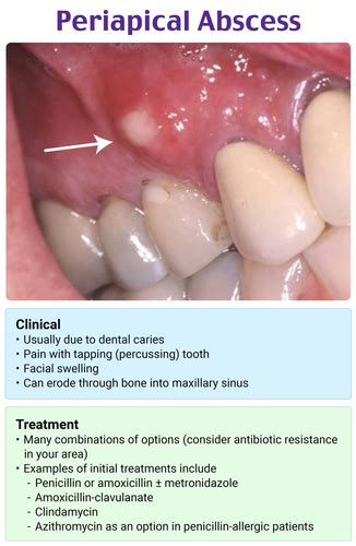 Pance Exam D Part 1 Flashcards Quizlet