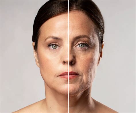 Importance Of Skin Microbiome And Its Relation In Skin Aging Blumen