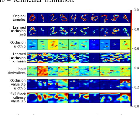techniques for visualizing lstms applied to electrocardiograms