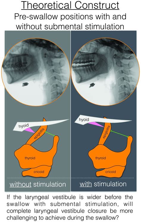 Effects Of Submental Surface Electrical Stimulation On Swallowing