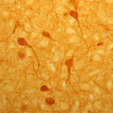 Calbindin D 28 Antibody Immunostar